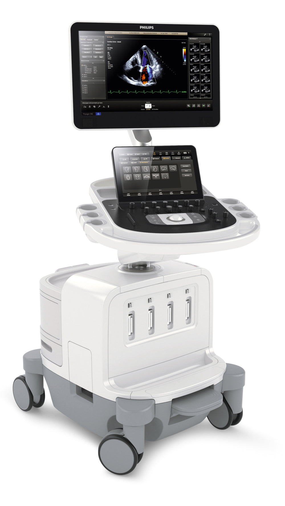 Philips EPIQ Ultrasound System